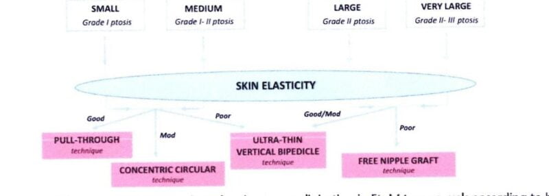 FTM Top Surgery (Transgender Mastectomy) | Mandell-Brown Plastic ...